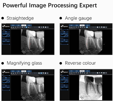 Eighteeth Nanopix1 Dental Rvg Sensor - Fdidentist Dental Supplier UK